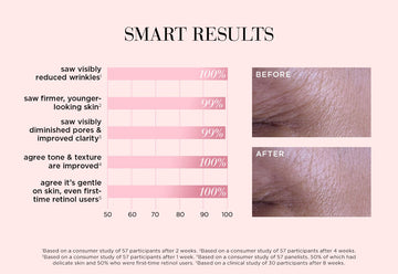 Gentle Retinol + HPR Ceramide Water Cream | Elizabeth Arden