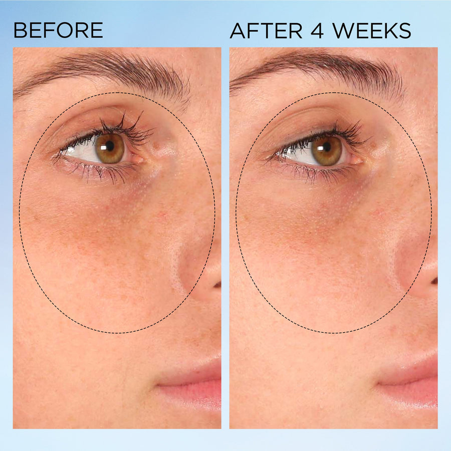 Visible Brightening Clearly Radiant Dark Spot Skin Serum – Elizabeth Arden