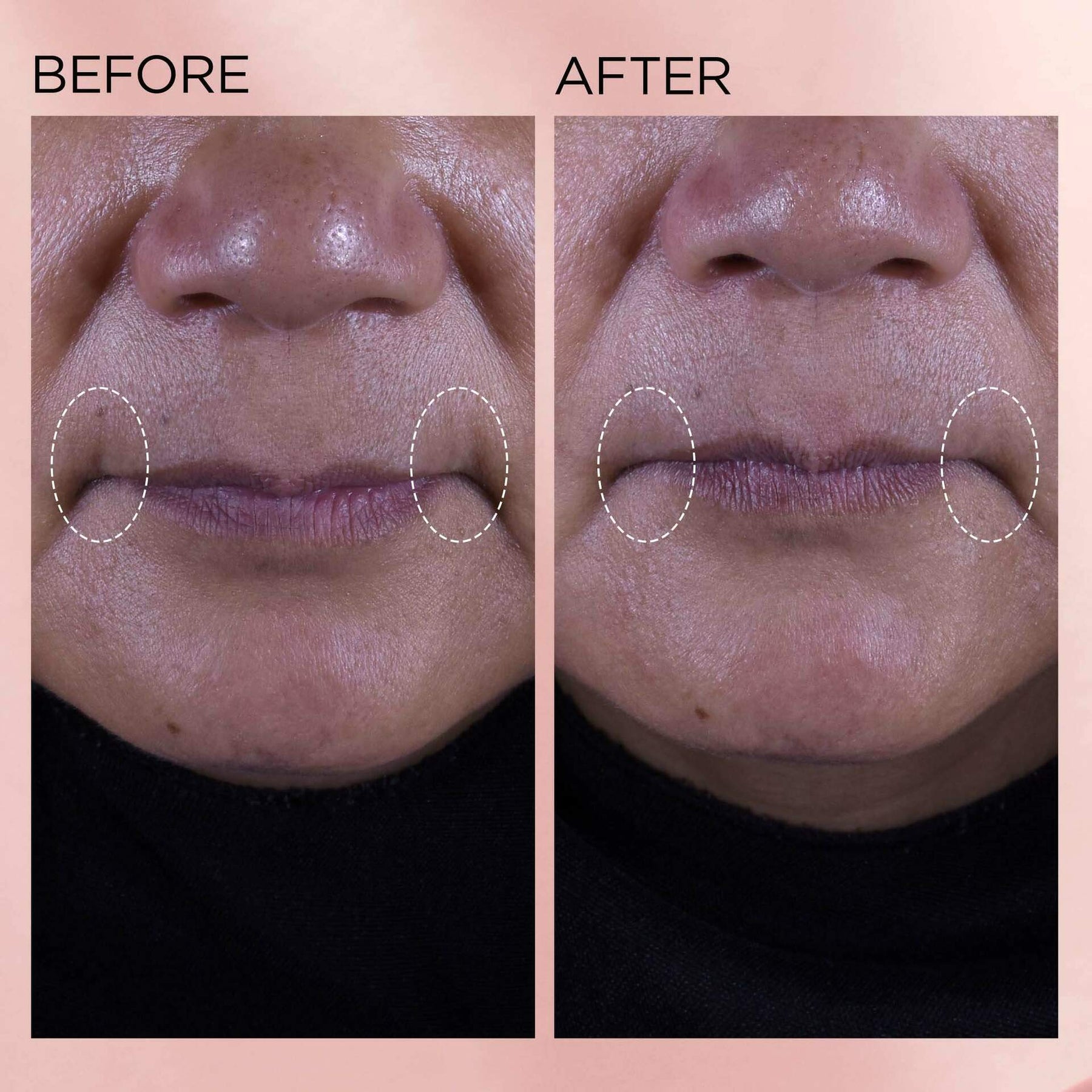 Gentle Retinol + HPR Ceramide Water Cream | Elizabeth Arden